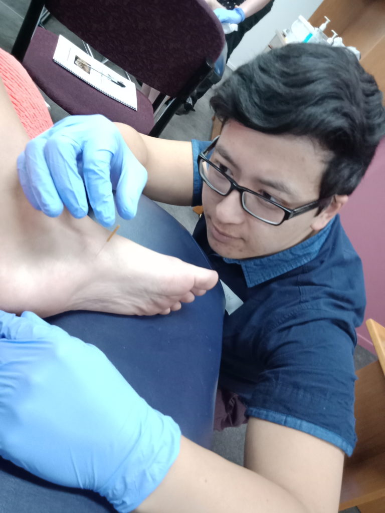 What is ‘Dry Needling’? - Holistic Foot Clinic
